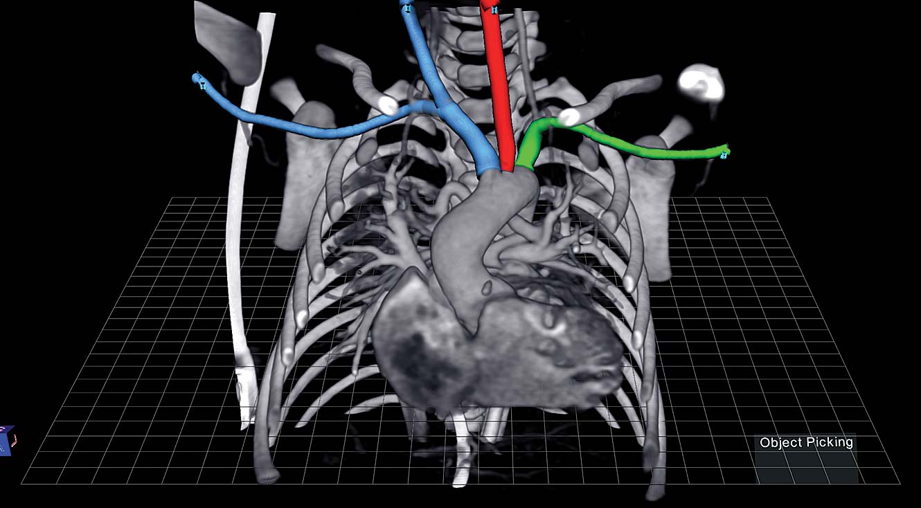 Innovations: Making 3-D medical imaging a reality | Modern Healthcare