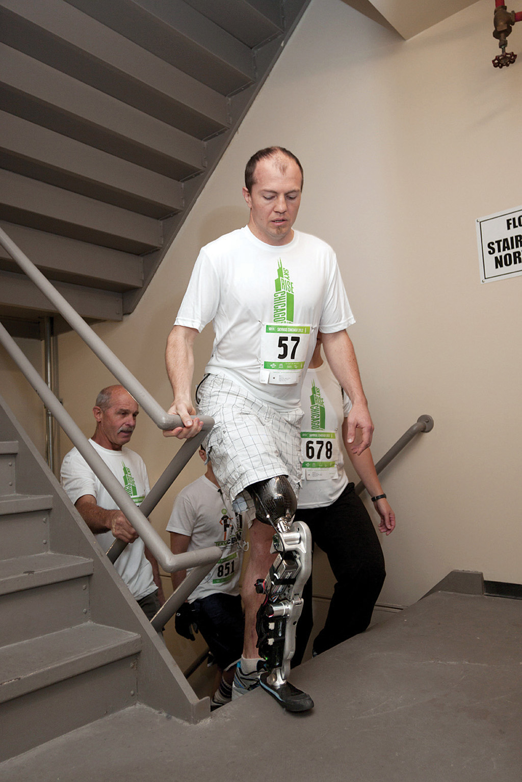 Outliers: 'Bionic' leg aids amputee | Modern Healthcare