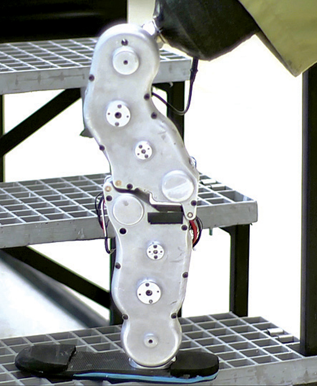 Outliers: 'Bionic' leg aids amputee | Modern Healthcare
