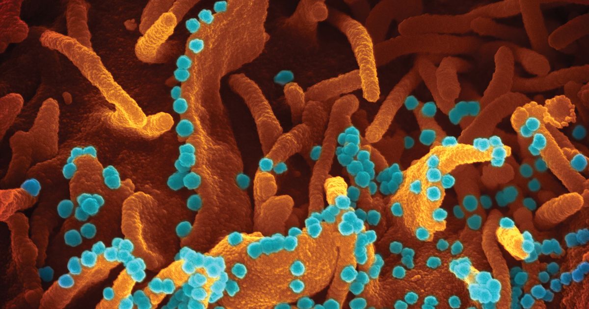 CDC commits $90M for pathogen genomics research centers | Modern Healthcare