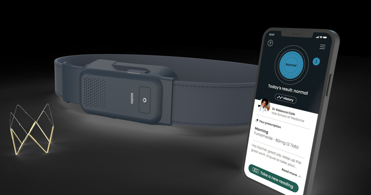 Fire1 lands $120M to test Norm heart monitoring device | Modern Healthcare