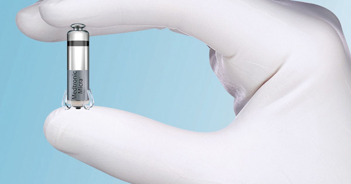 Cost may be a hurdle for the first FDA-approved leadless pacemaker ...