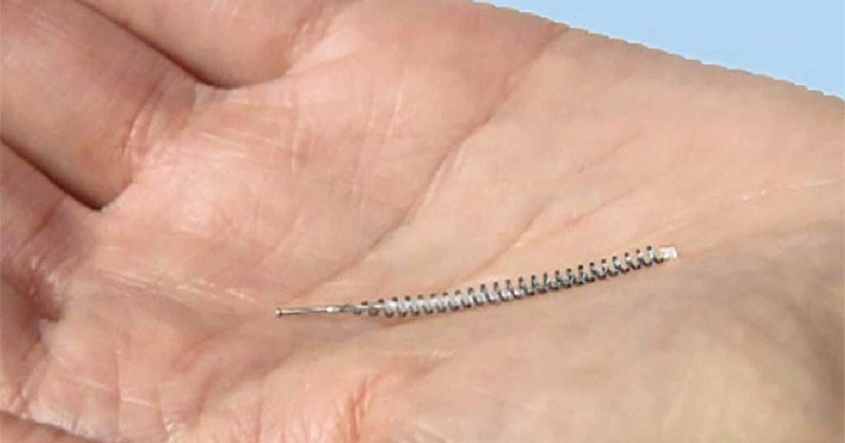 Essure problems cost Bayer $413 million last year alone | Modern Healthcare