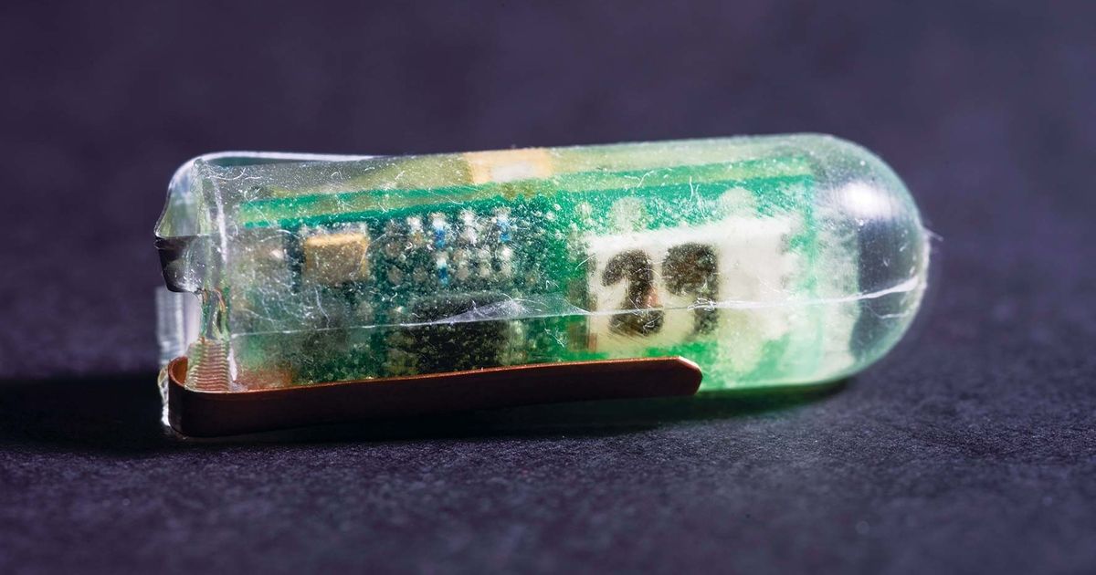 Ingestible medical sensor powered by stomach acid can monitor health ...