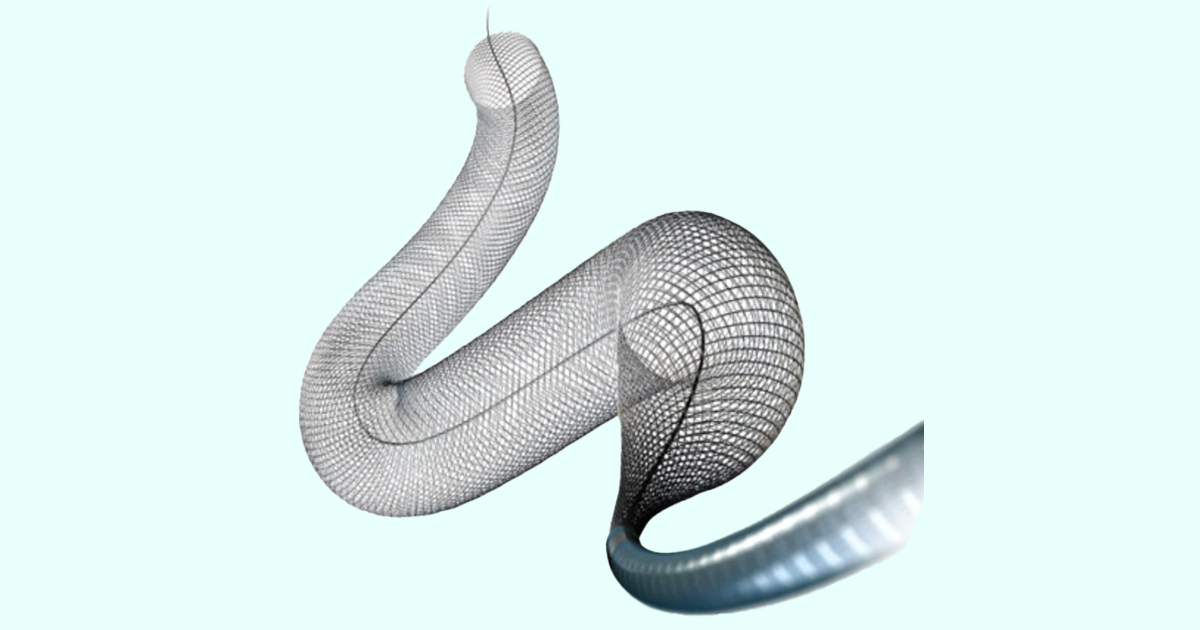 FDA deems Medtronic’s Pipeline Vantage recall ‘most serious’ | Modern ...