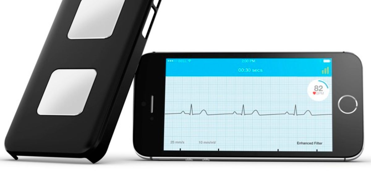 ECG monitor app helps users find heart rhythm issues | Modern Healthcare