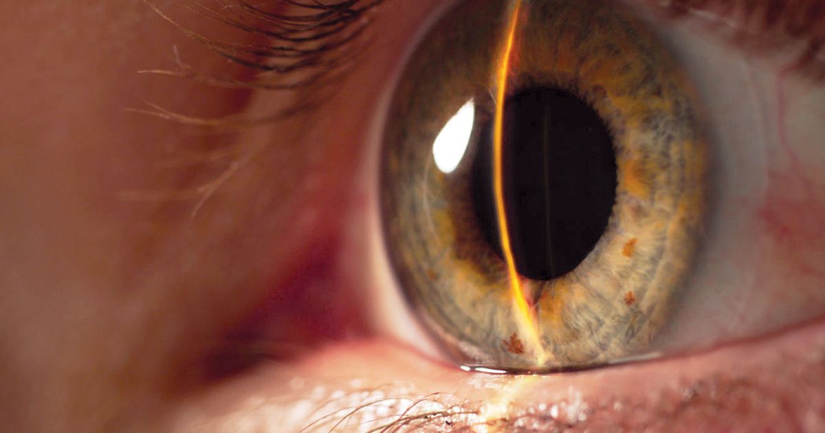 Detecting heart disease with a look—and some AI | Modern Healthcare