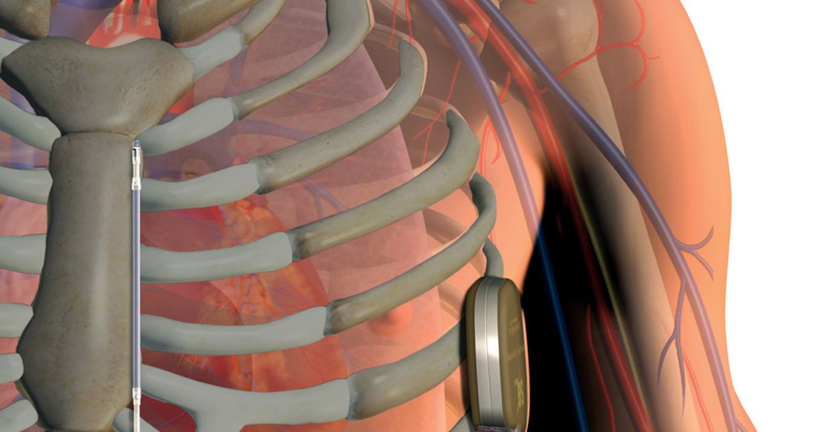 Boston Scientificto buy C.R. Bard electrophysiology business for $275M ...