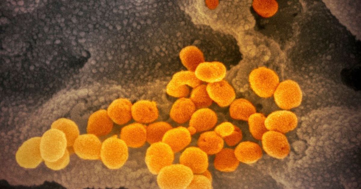 Low white blood cell counts linked to severe COVID-19 cases | Modern ...